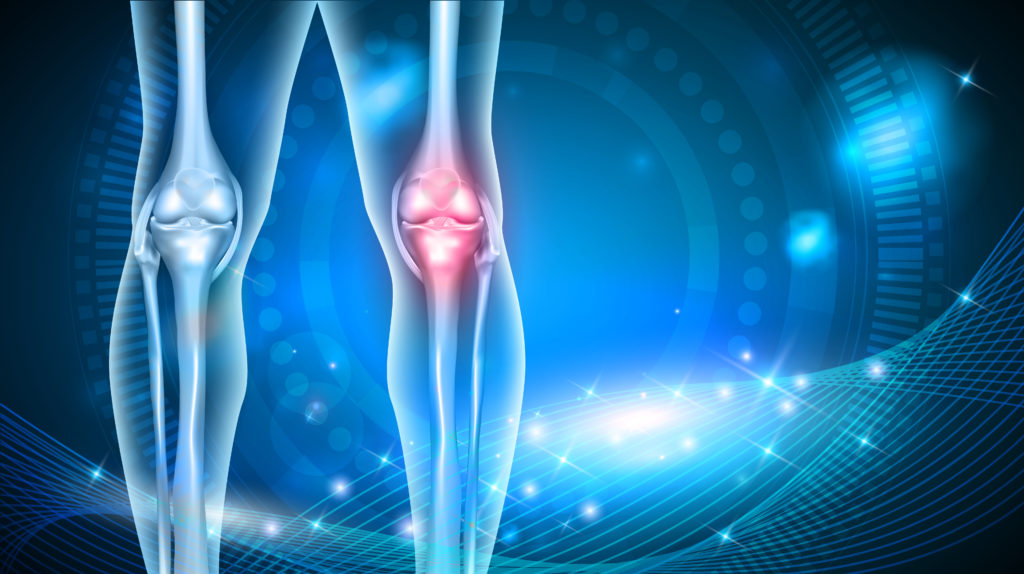 Total Knee Replacement | Genesis Orthopedics & Sports Medicine