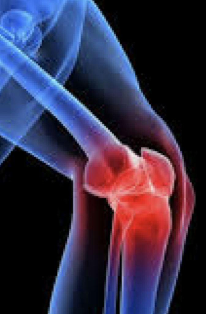 Expert ACL Repair Surgery | Genesis Ortho & Sports Medicine